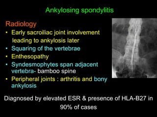 Seronegative disorders1 | PPT
