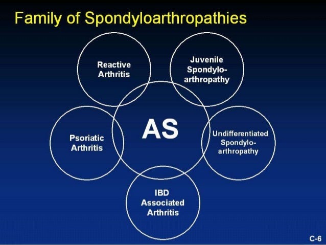 Seronegative Spondyloarthropathies