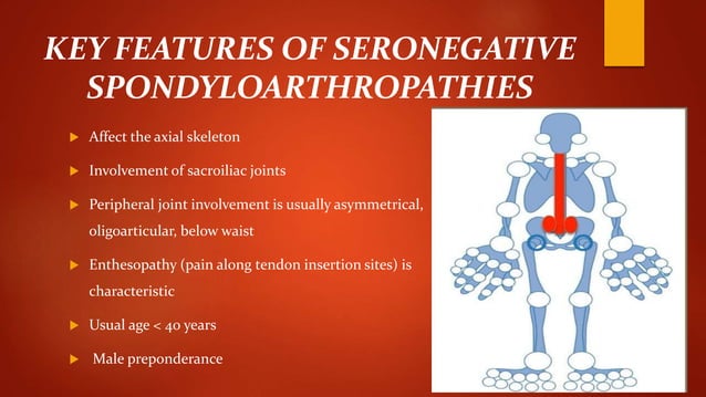 Seronegative spondyloarthropathy | PPT