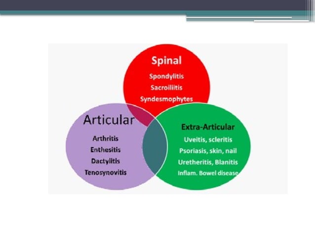 Seronegative spondyloarthropathy presentation.pptx