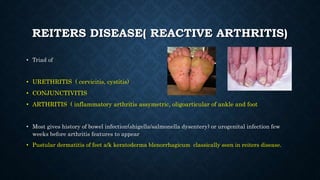 seronegative spondyloarthropaty.pptx