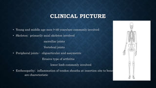 seronegative spondyloarthropaty.pptx