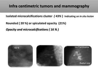 Jean Yves Seror : Breast cancer : Small lesion imaging features | PDF