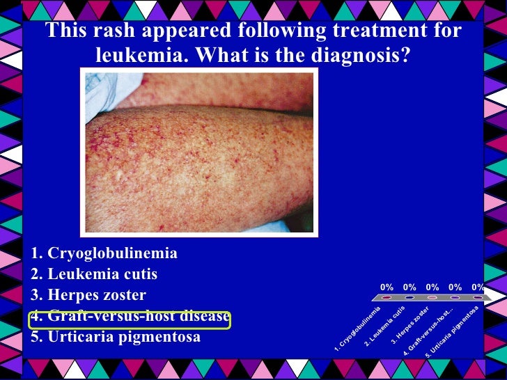 Serotoninsyndrome Ser (1) (1)