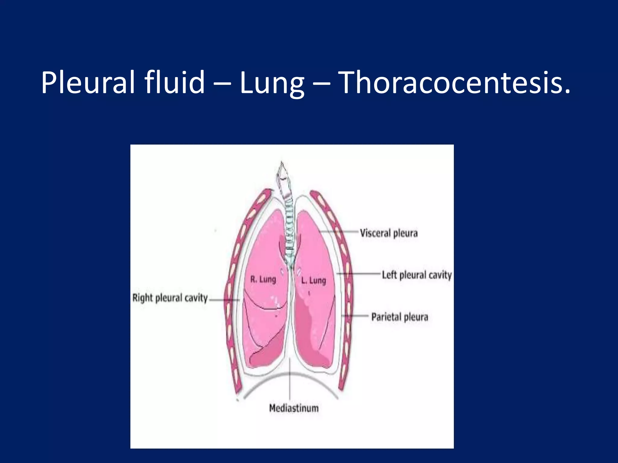 Fluid cytology in serous cavity effusions | PPTX