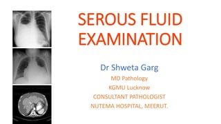 serous fluid Dr shweta [Autosaved].pptx