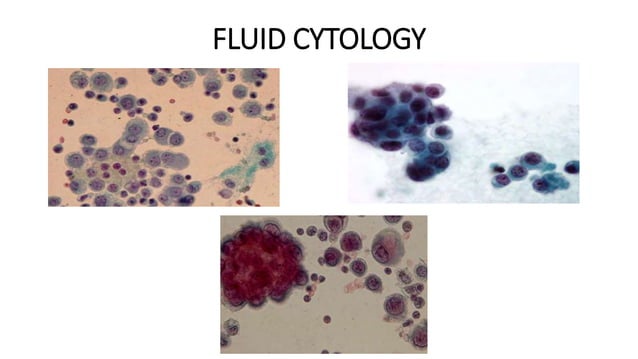 serous fluid Dr shweta [Autosaved].pptx | Lung and Respiratory Health ...