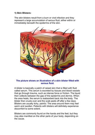 Serous Inflammation | DOC