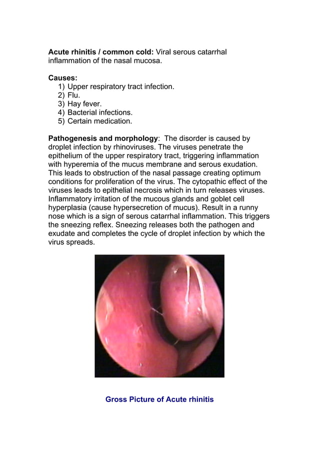 Serous Inflammation | DOC