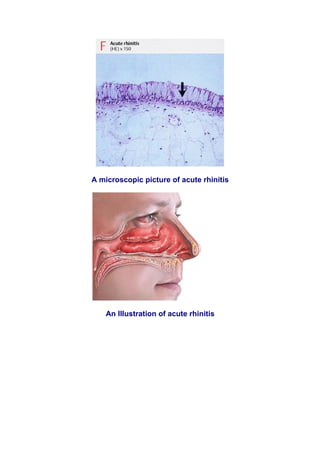 Serous Inflammation | DOC