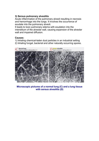 Serous Inflammation | DOC