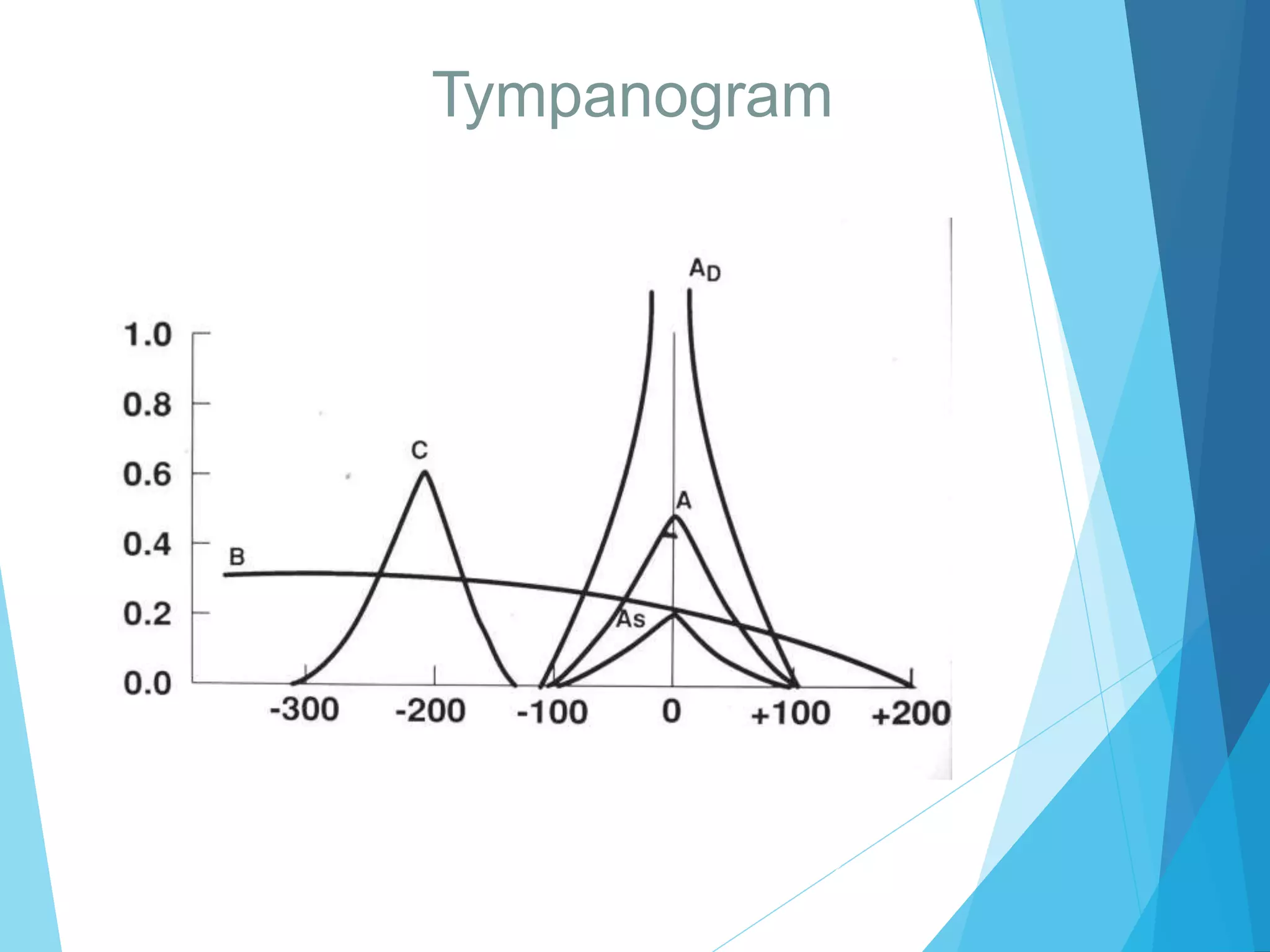 Serous otitis media | PPTX