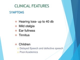 Serous otitis media | PPTX
