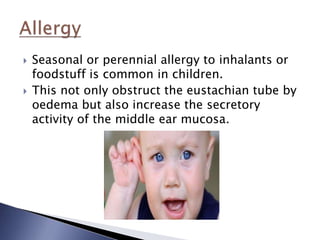SEROUS OTITIS MEDIA.final.pptx