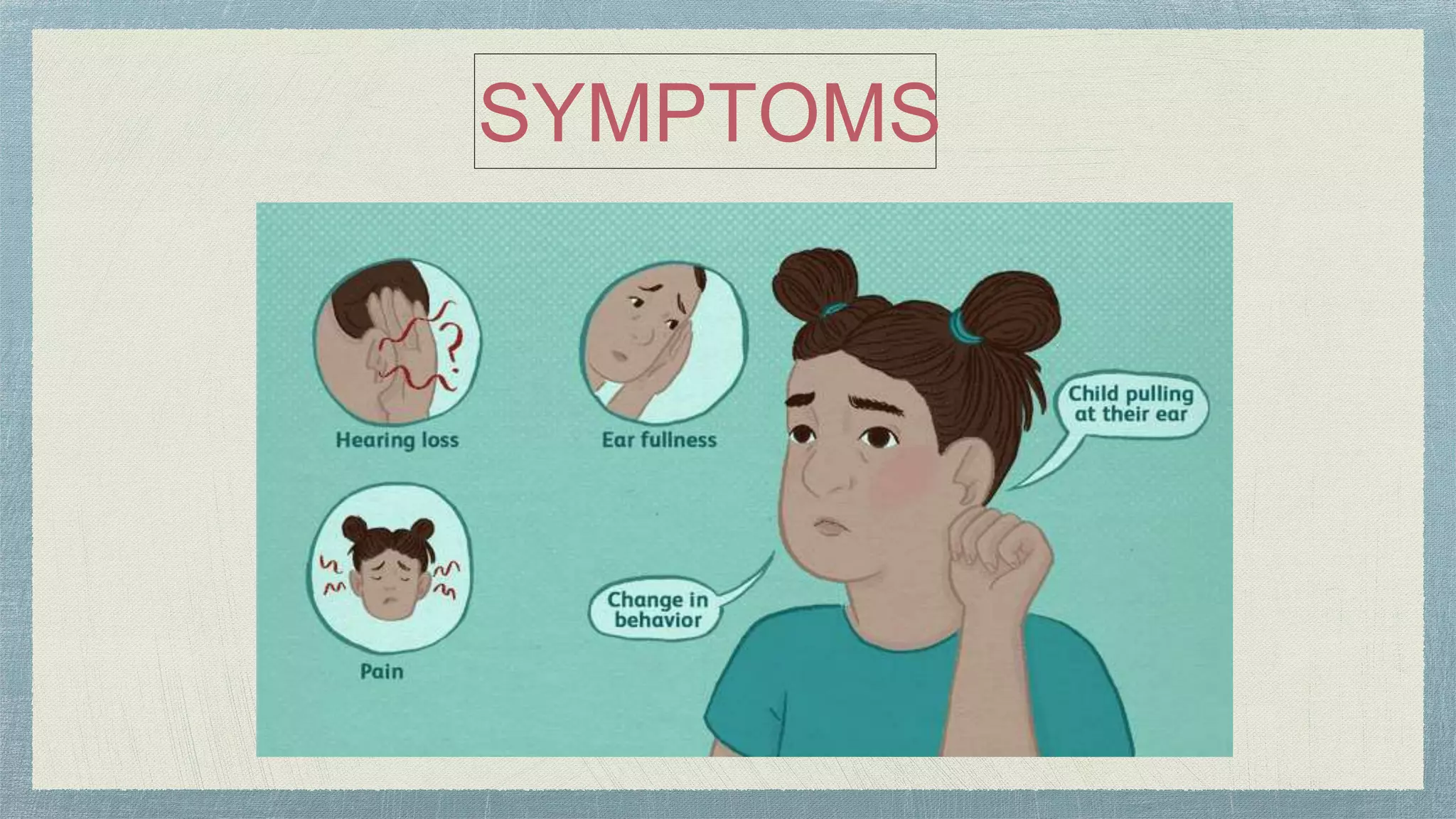 Serous Otitis Media (SOM) | PPTX