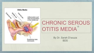 Serous Otitis Media (SOM) | PPT