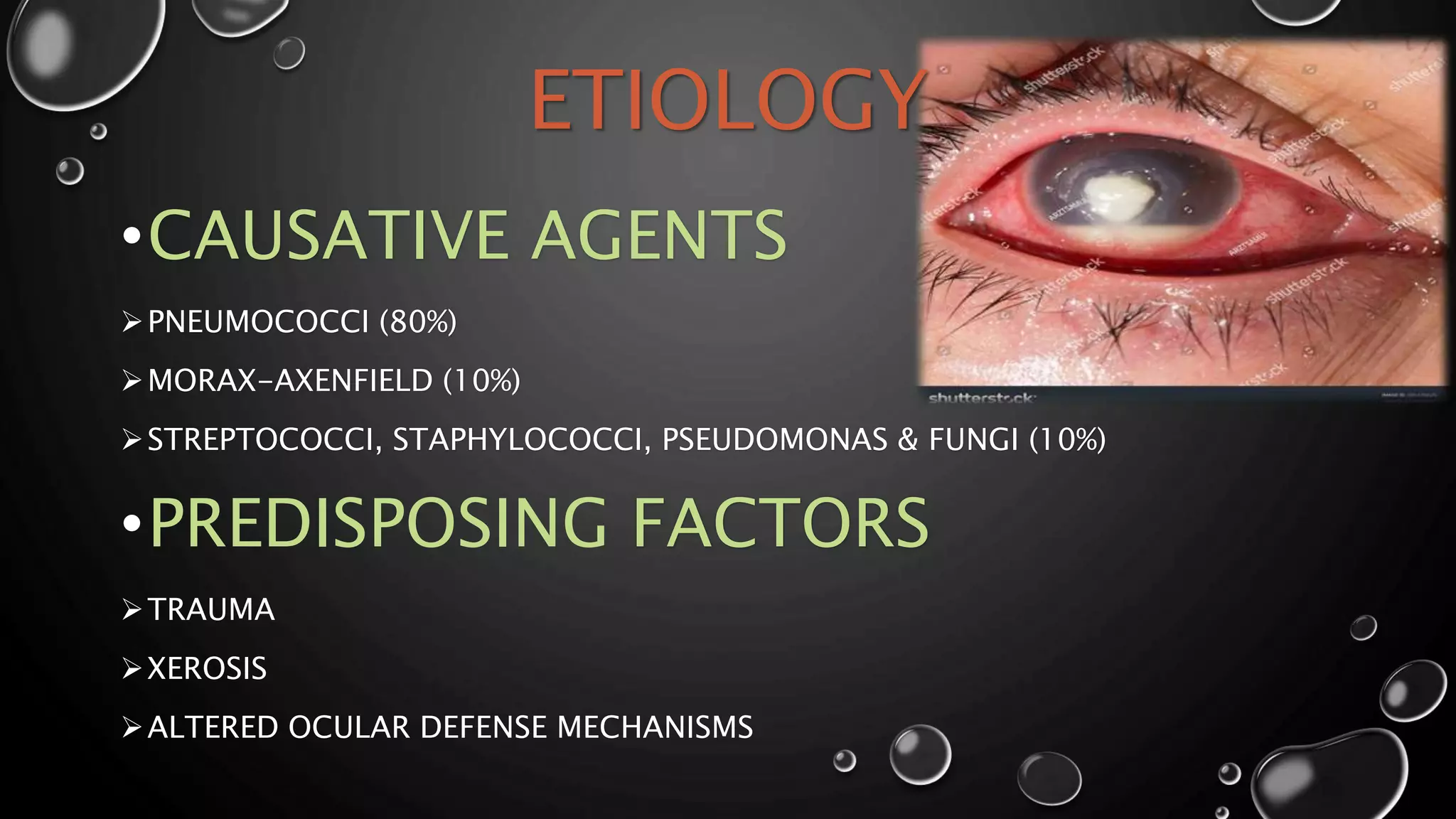 Serpiginous corneal ulcers | PPTX