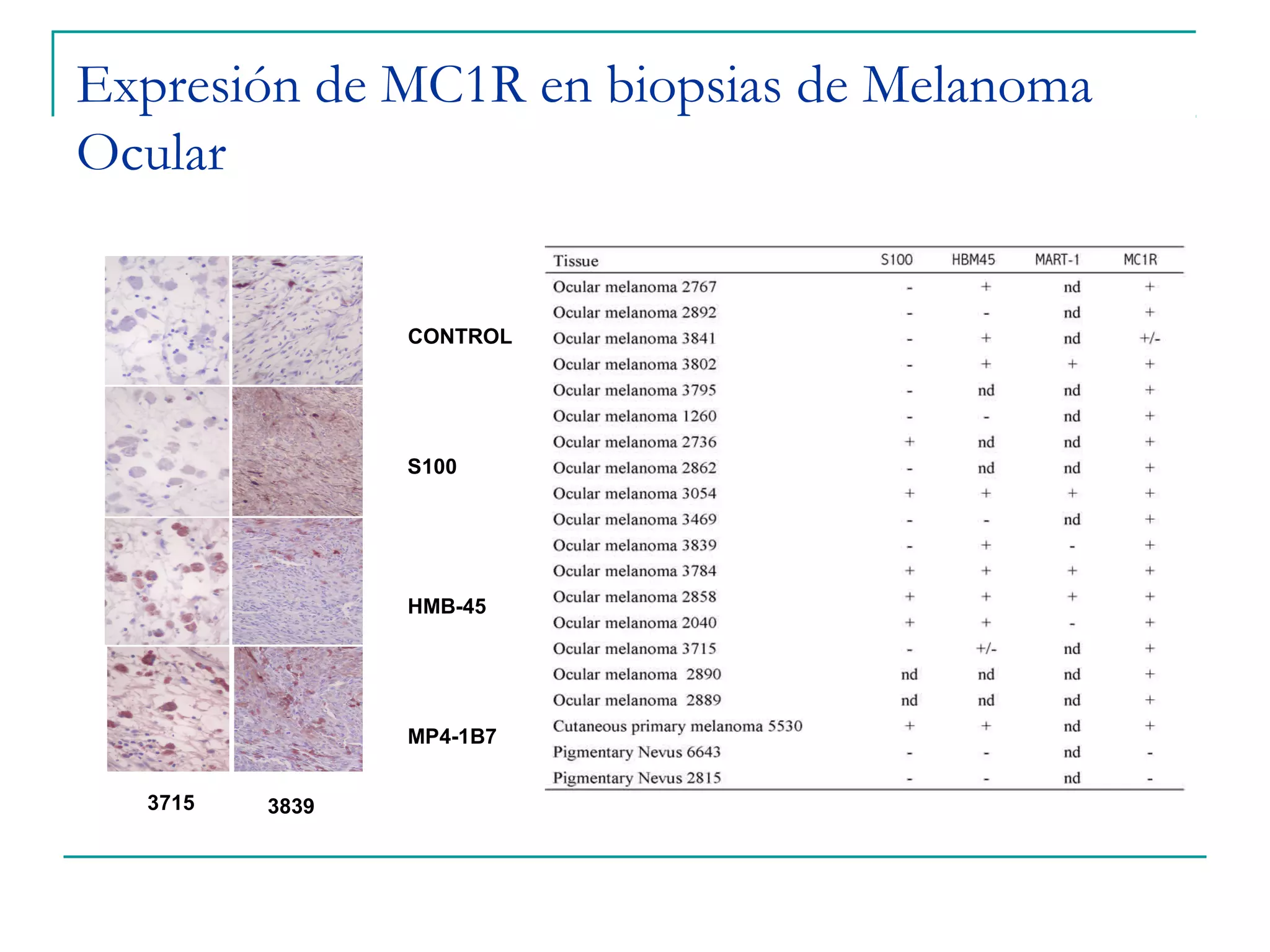 Citoquinas Proinflamatorias Inducen la Expresión del Receptor MC1R en ...