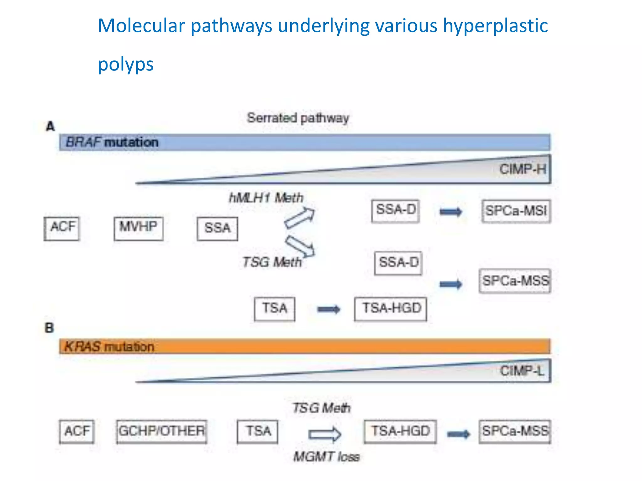 Serrated pathway to colorectal neoplasia | PPTX