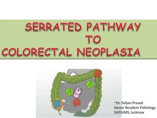 Serrated pathway to colorectal neoplasia | PPT
