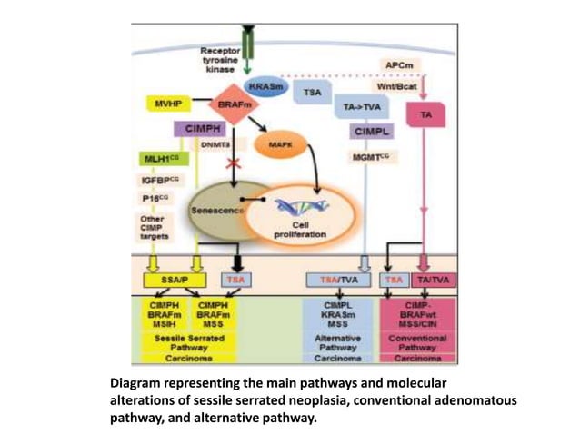 Serrated pathway to colorectal neoplasia | PPTX