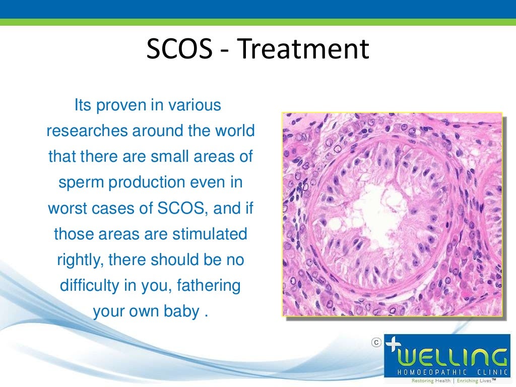 Sertoli Cell Only Syndrome Images And Photos Finder