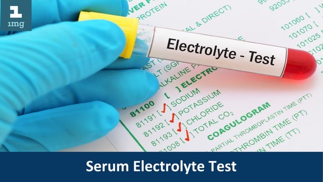 Serum electrolytes test | ODP | Heart and Cardiovascular Diseases ...
