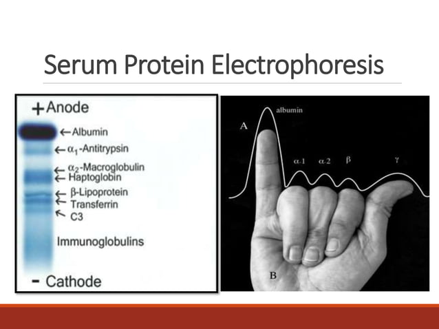 Gastrinbestimmung Im Serum , Labordiagnostik bei Verdacht auf ...