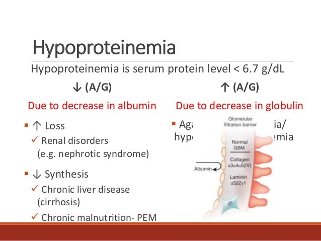 Albuminuria Normal Range