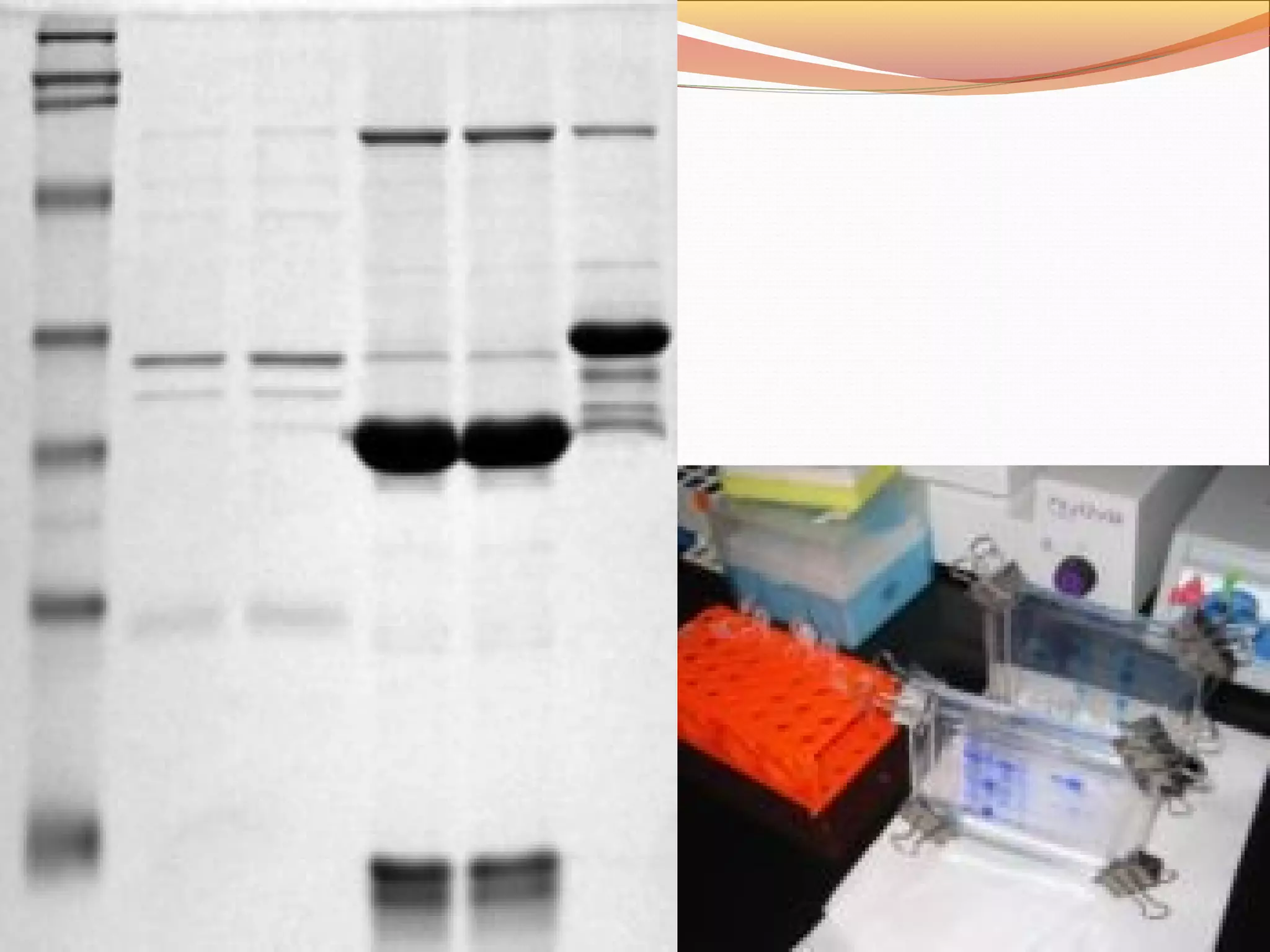 Serum protein electrophoresis & their clinical importance | PPT