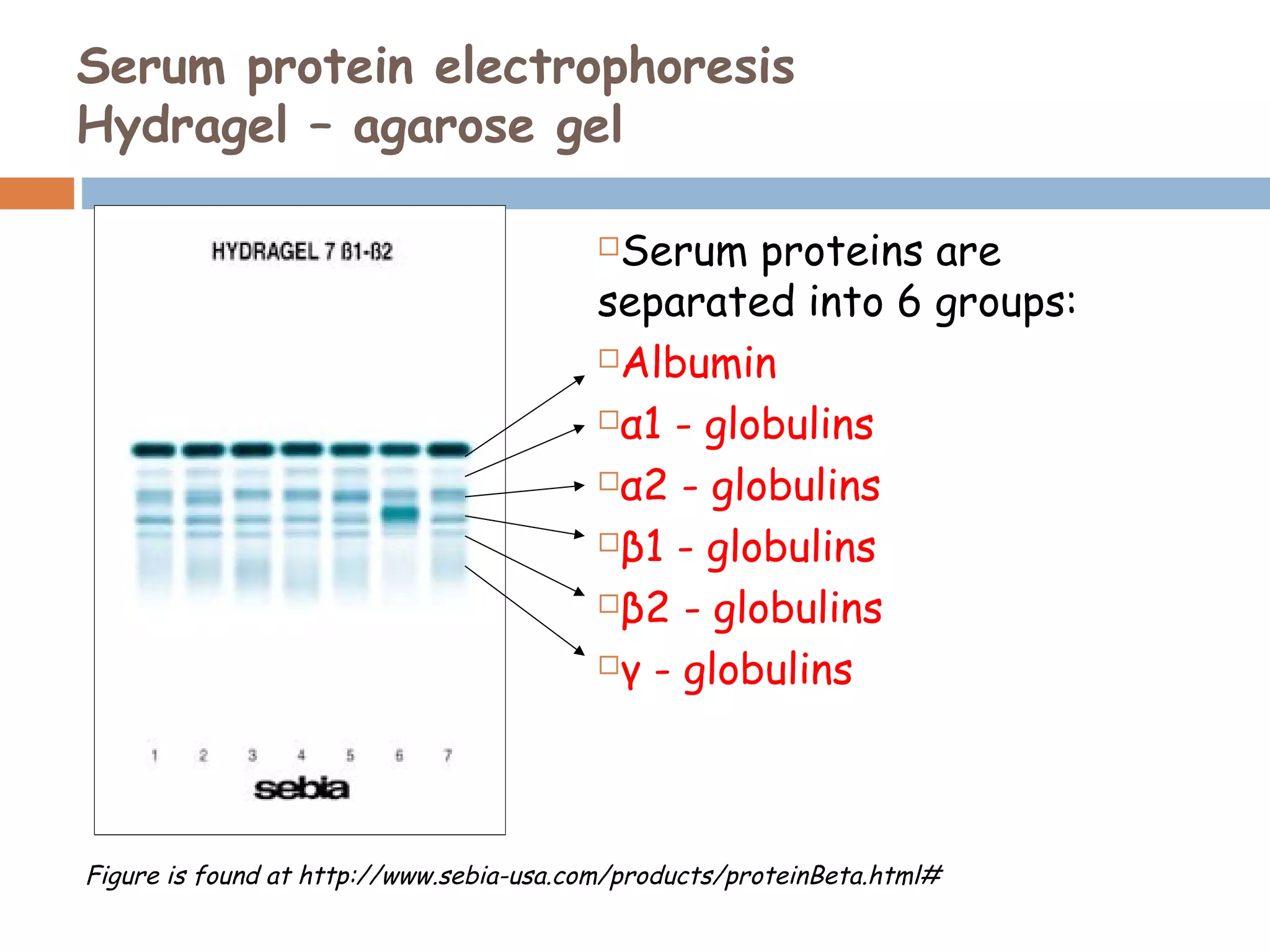 Serum protein electrophpresis | PPT
