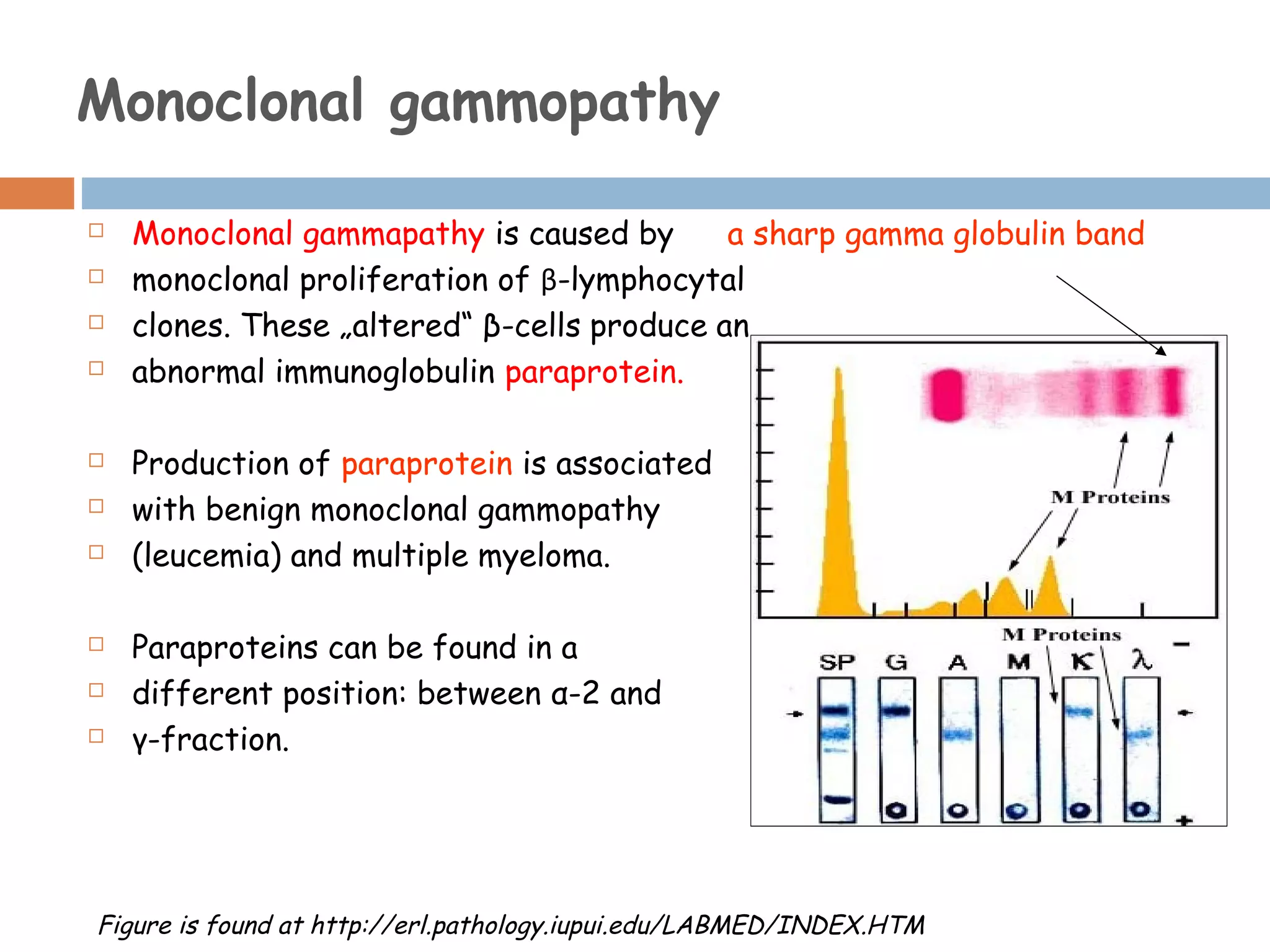 Serum protein electrophpresis | PPT