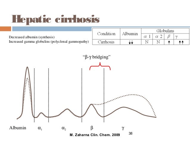 Serum protein electrophpresis