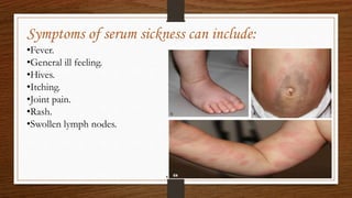 Serum sickness | PPTX