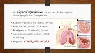 Serum sickness | PPTX