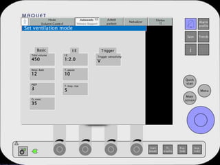 Servoi mechanical ventilation | PPTX