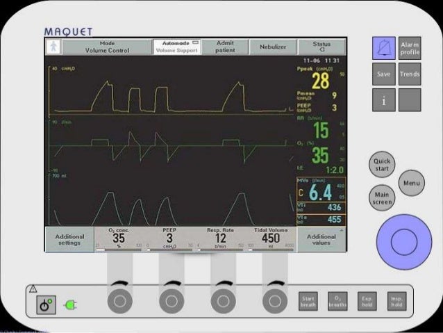 Servoi mechanical ventilation