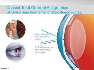 OPHTHALMOLOGY INNOVATION SHOWCASE - Cassini | PPT