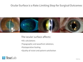 DIAGNOSTICS-IMPACT ON THE PREMIUM CHANNEL – TearLab | PPT