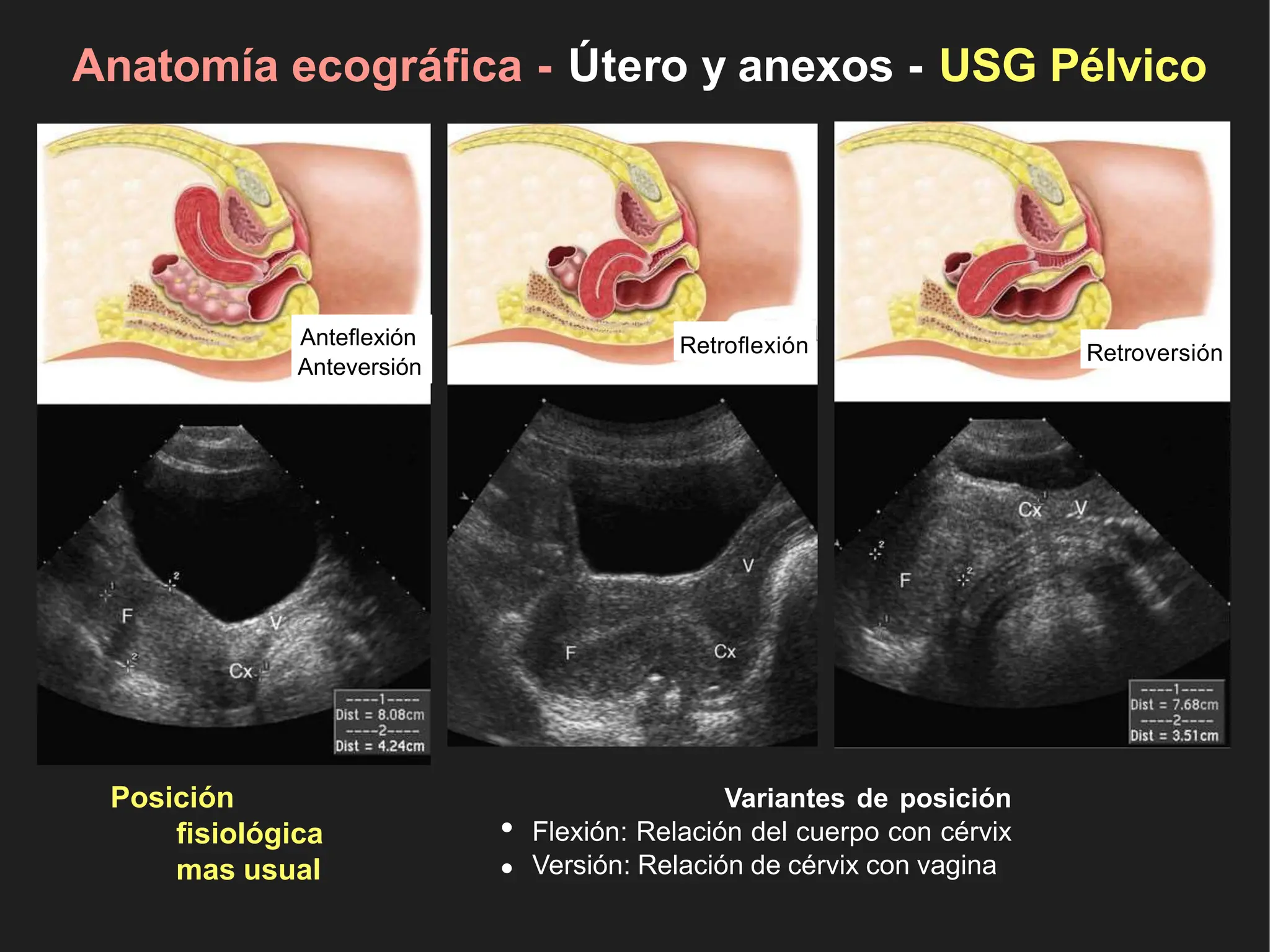SESIÓN 11 - Ginecología - Útero y anexos.ppt