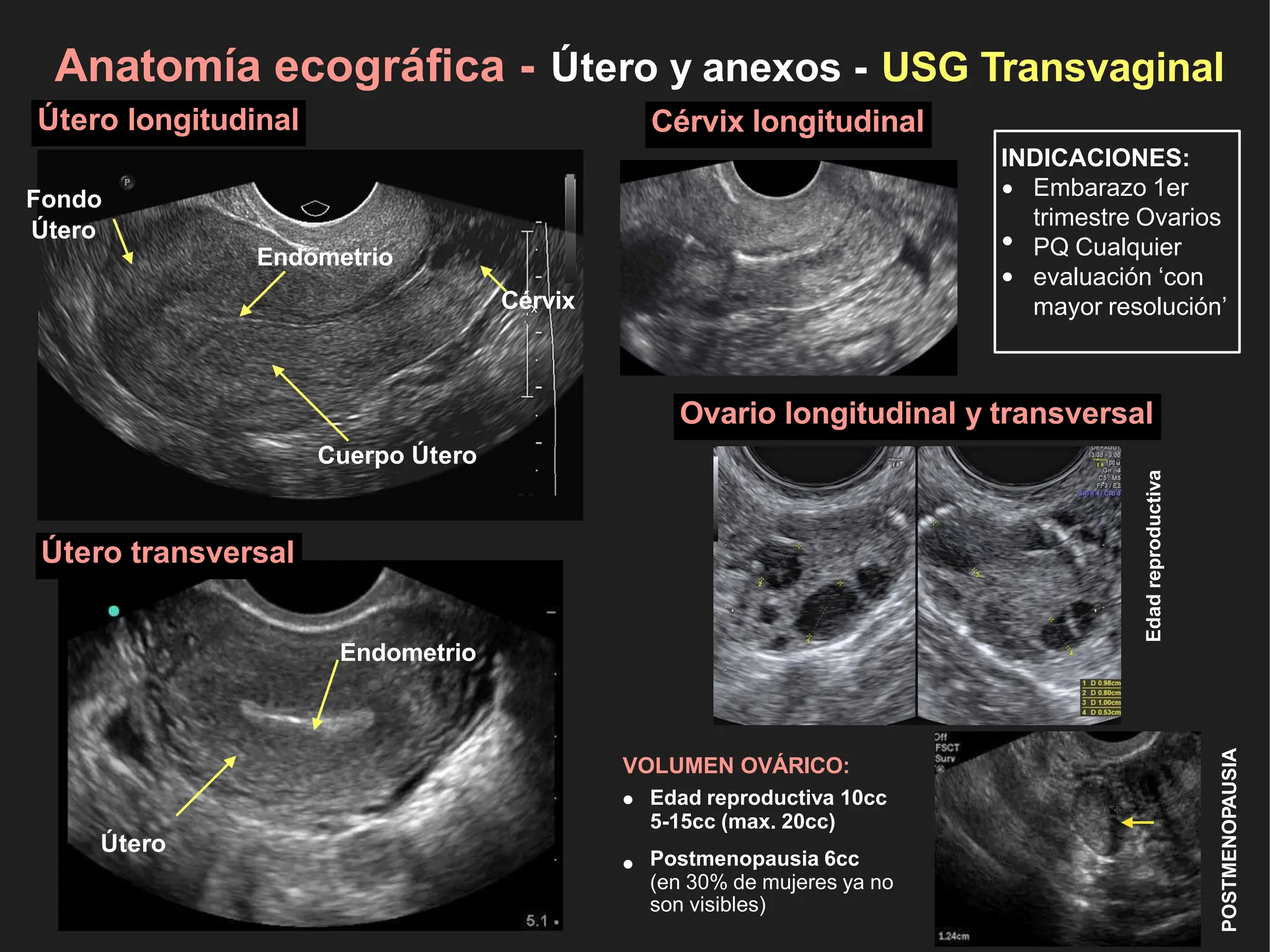 SESIÓN 11 - Ginecología - Útero y anexos.ppt