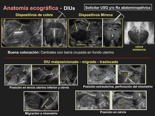 SESIÓN 11 - Ginecología - Útero y anexos.ppt
