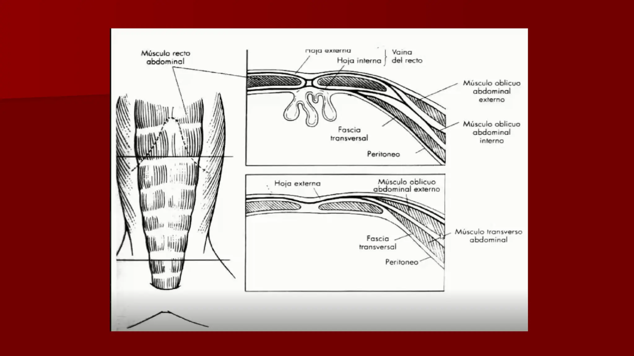 Sesión 9. Patología quirúrgica de la cavidad Abdominal.pptx