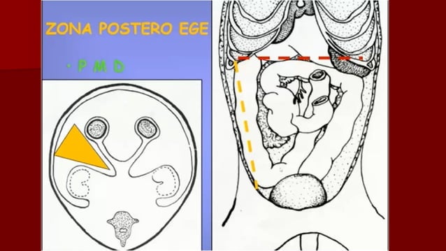 Sesión 9. Patología quirúrgica de la cavidad Abdominal.pptx