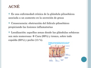 Sesión acné | PPT