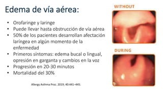 Caso Clínico: Abordaje de Angioedema | PPTX