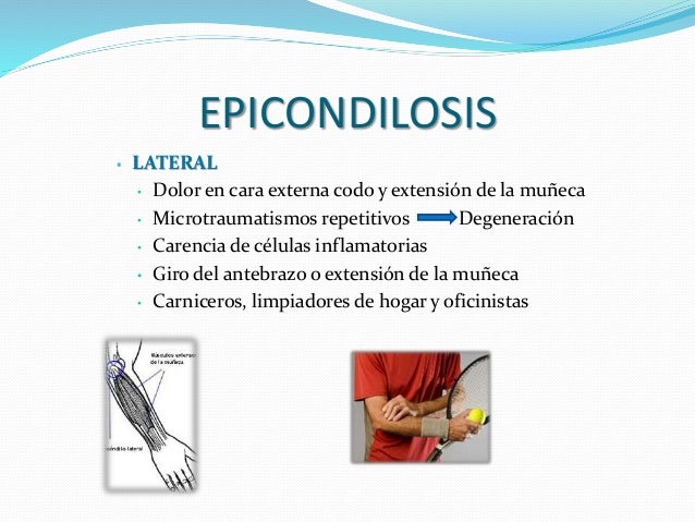 Dolor de codo