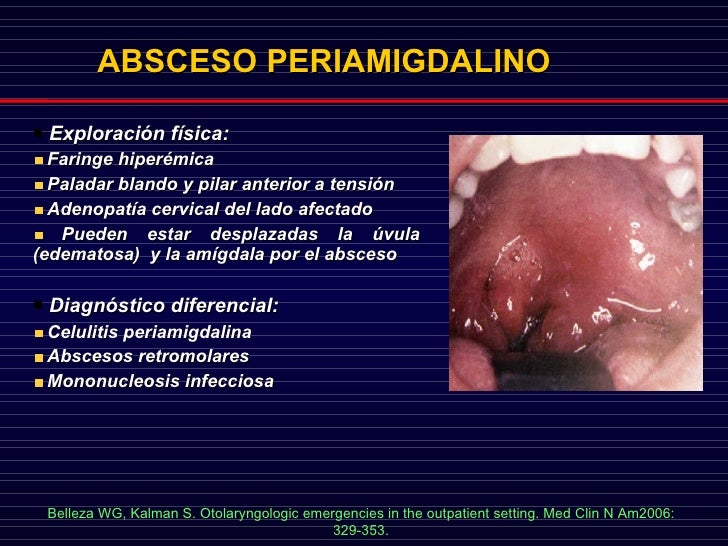 CASO CLINICO PATOLOGIA CUELLO