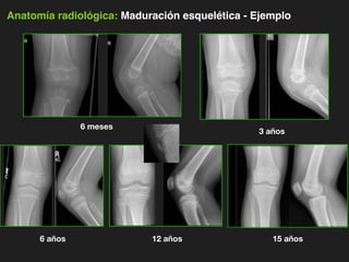 SESIÓN 15 - Imagenología Musculoesquelética.pdf