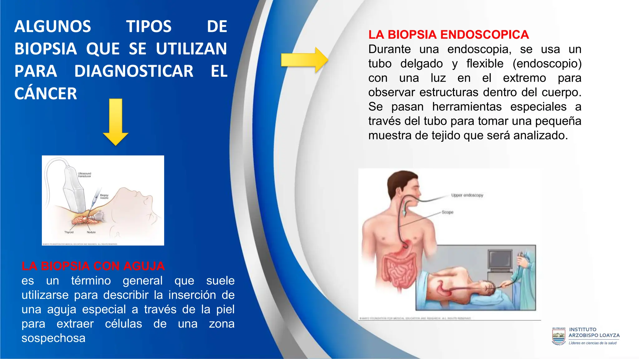 SESION 2 - BIOPSIA.pdf cáncer y sus tipos | PDF